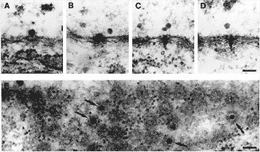 (see alsoanother micrograph of the same view, using anotherpreparation ...